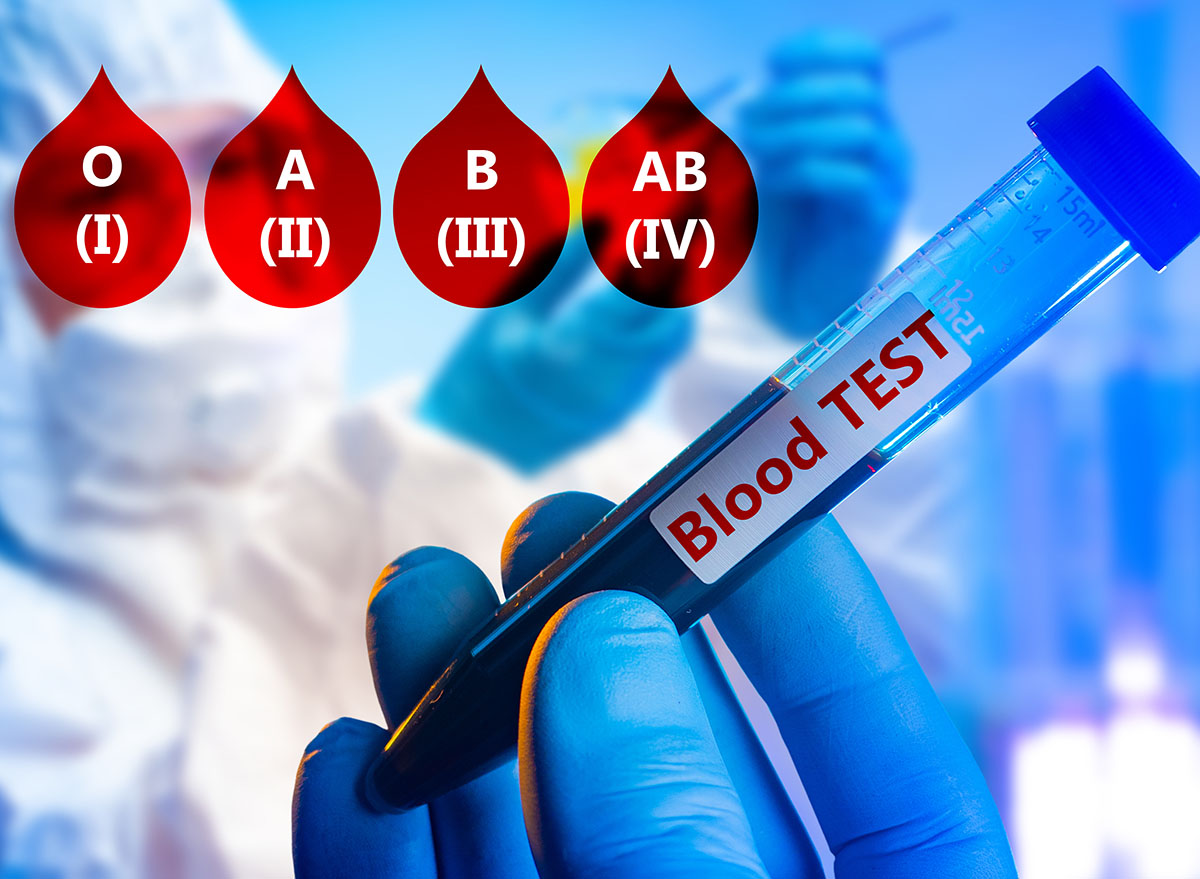 This Blood Type Puts You at Risk for Dementia