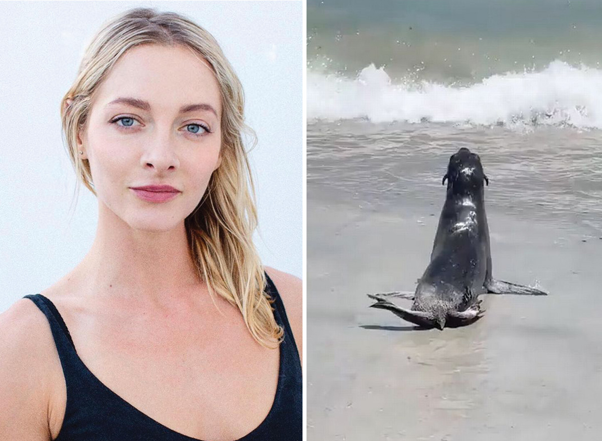 Actress Was Attacked and Bitten by Angry Seal on a Popular Beach