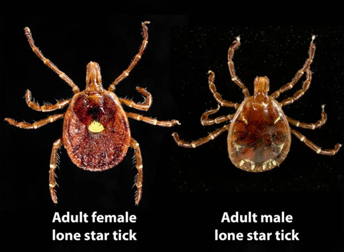 Beware the “Lone Star” Tick: A Bite Triggers Meat Allergy in Man
