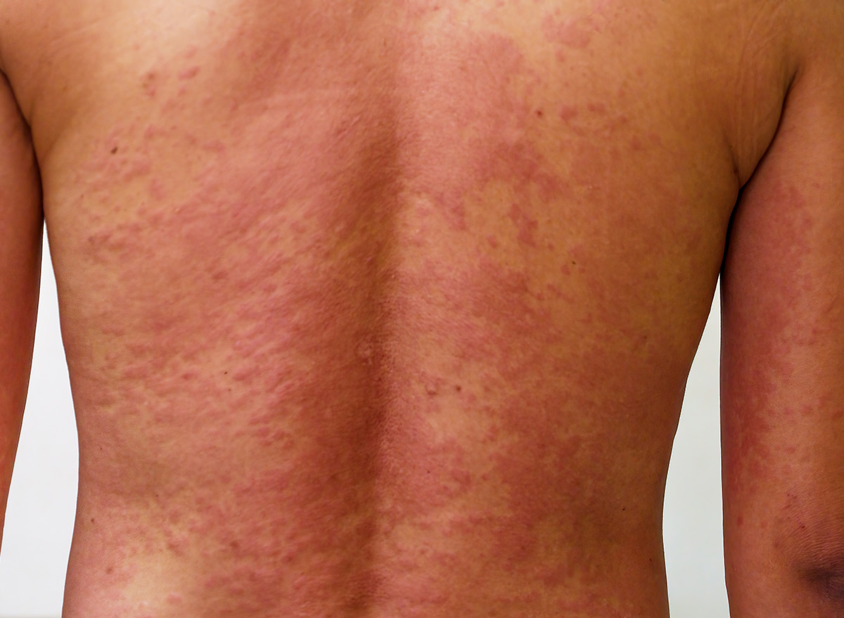 9 COVID Symptoms to Know as 1,200 People Die Weekly