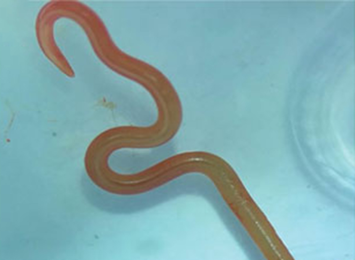 3-Inch Live Worm Found Woman’s Brain in World-First Discovery