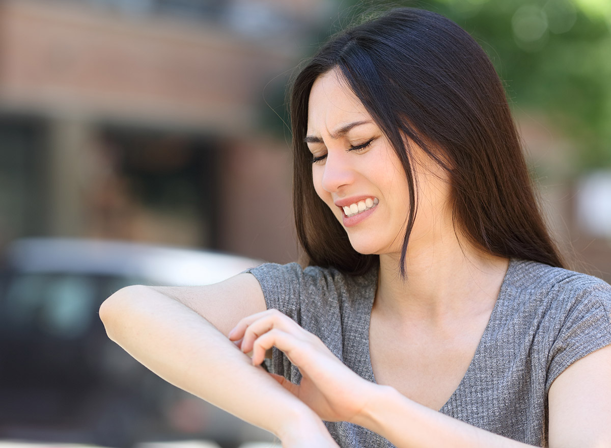 Tropical Skin Disease Hits America, Here’s How to Protect Yourself